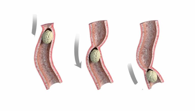 Intestino felice: anatomia, consigli ed esercizi utili - Blog